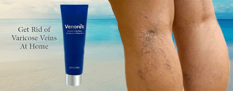 Venorex Cream Review for 2025 - Is it Actually Effective?